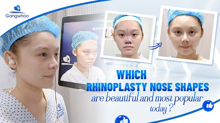 Top 6 Trendy and Beautiful Nose Shapes for 2026
