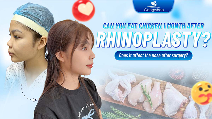 Can I Eat Chicken One Month After Rhinoplasty? Does It Affect the Nose ...
